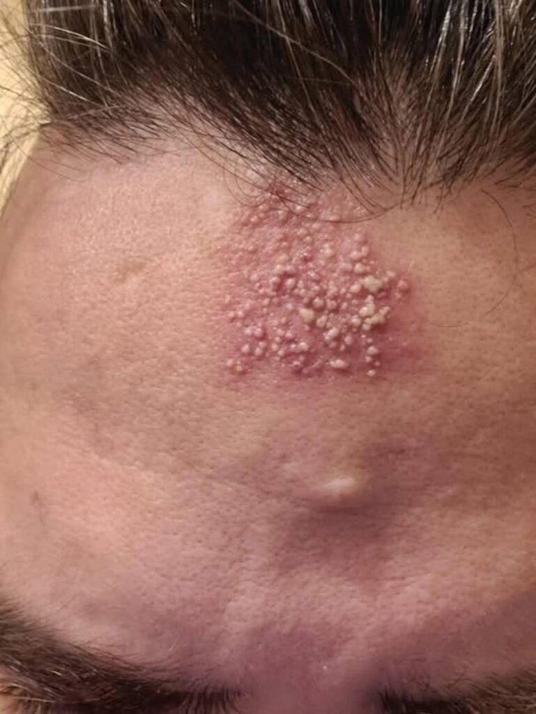 These are the consequences of sleeping with…See more – My Blog