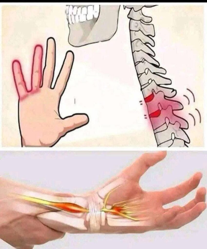 Why You Might Be Waking Up with Tingling Hands: Causes and Remedies ...