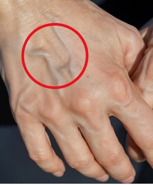 If you have visible veins, it means you are… See more – My Blog