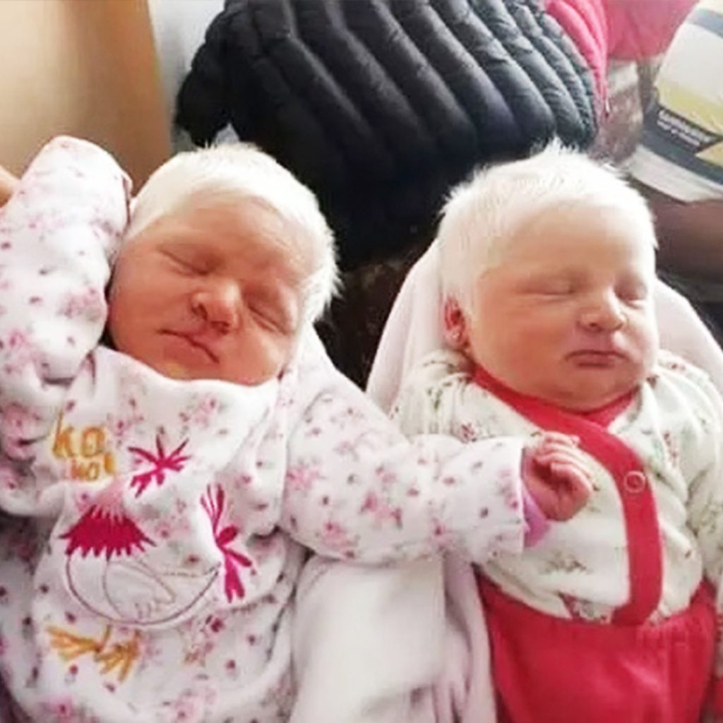 The First Ever Albino Twins Born In Argentina Will Leave You In Awe ...