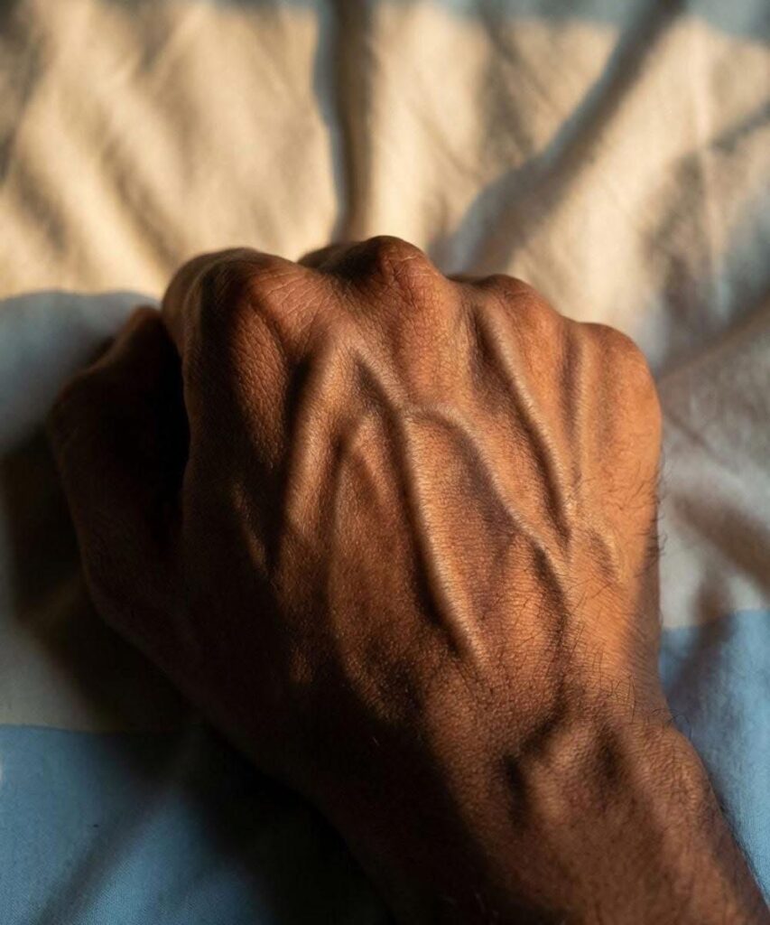 Why Your Veins Look More Visible at Night – My Blog